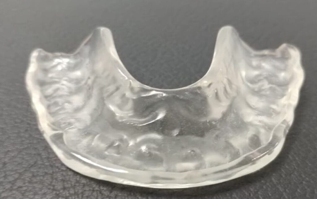 Night Guard The Key to Preventing Tooth Wear and Bruxism - Jdentallog