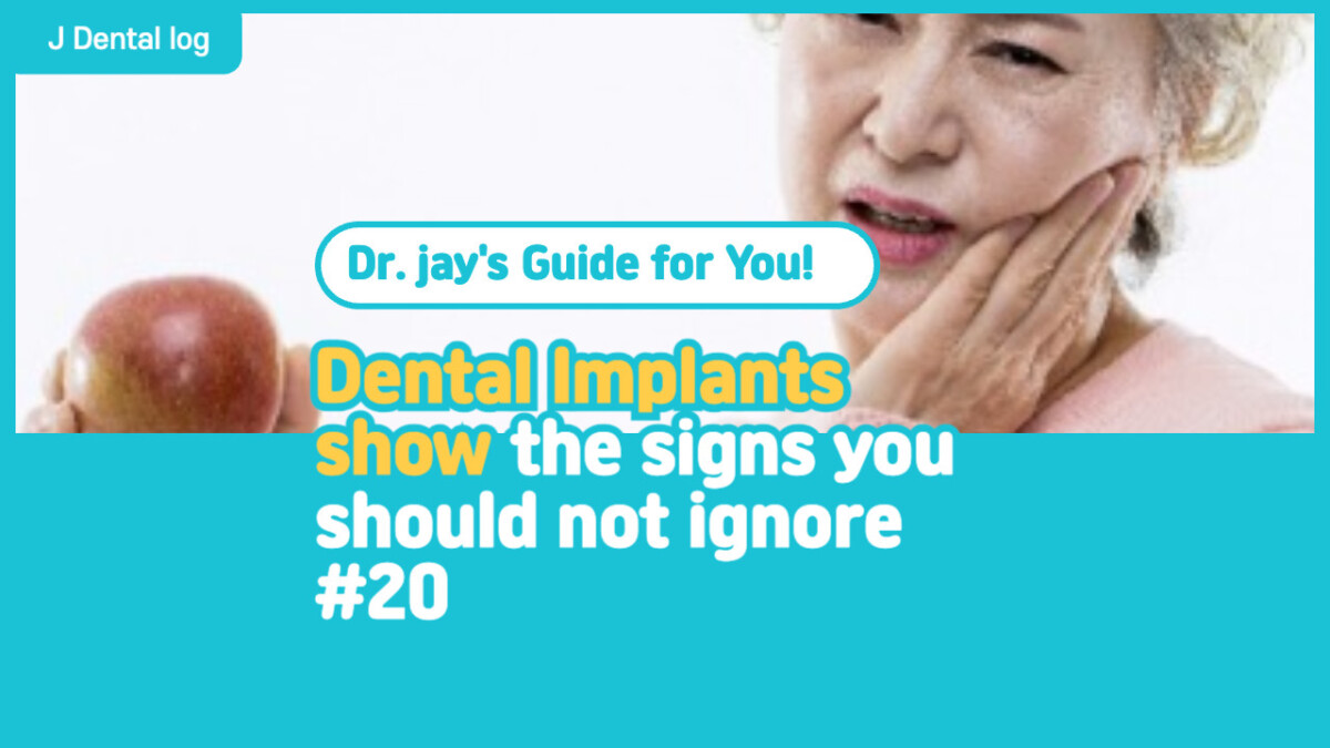 Dental Implants show the signs you should not ignore - Jdentallog